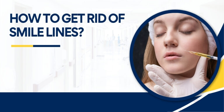 How to Get Rid of Smile Lines